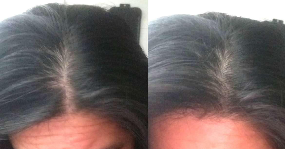 Edge Naturale Hair Follicle Enhancer Review - CHE Goes On